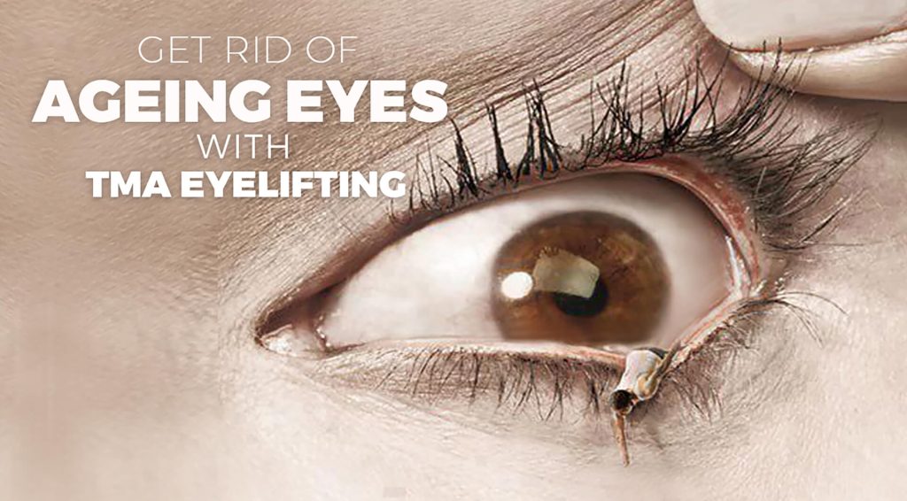 TMA Eyelifting | Achieve Bigger and Brighter Eyes with ONLY Aesthetics!